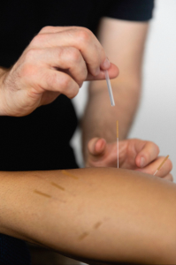 Remedial Massage Melbourne | My Recovery Lounge